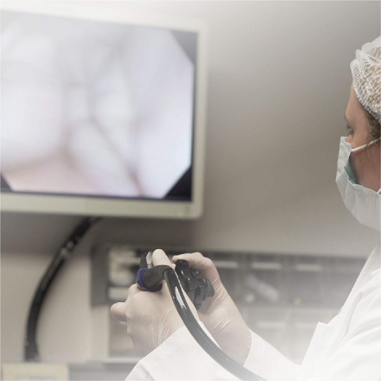 Endoscopía Digestiva Baja / Colonoscopía VCC - Gedyt